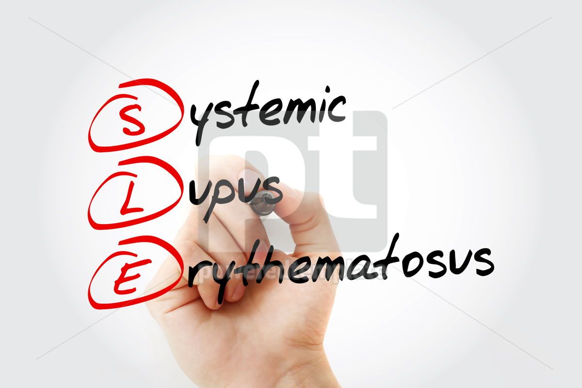 SLE - Systemic Lupus Erythematosus acronym with marker concept Stock ...