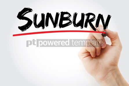 Sunburn text with marker Foto 68954