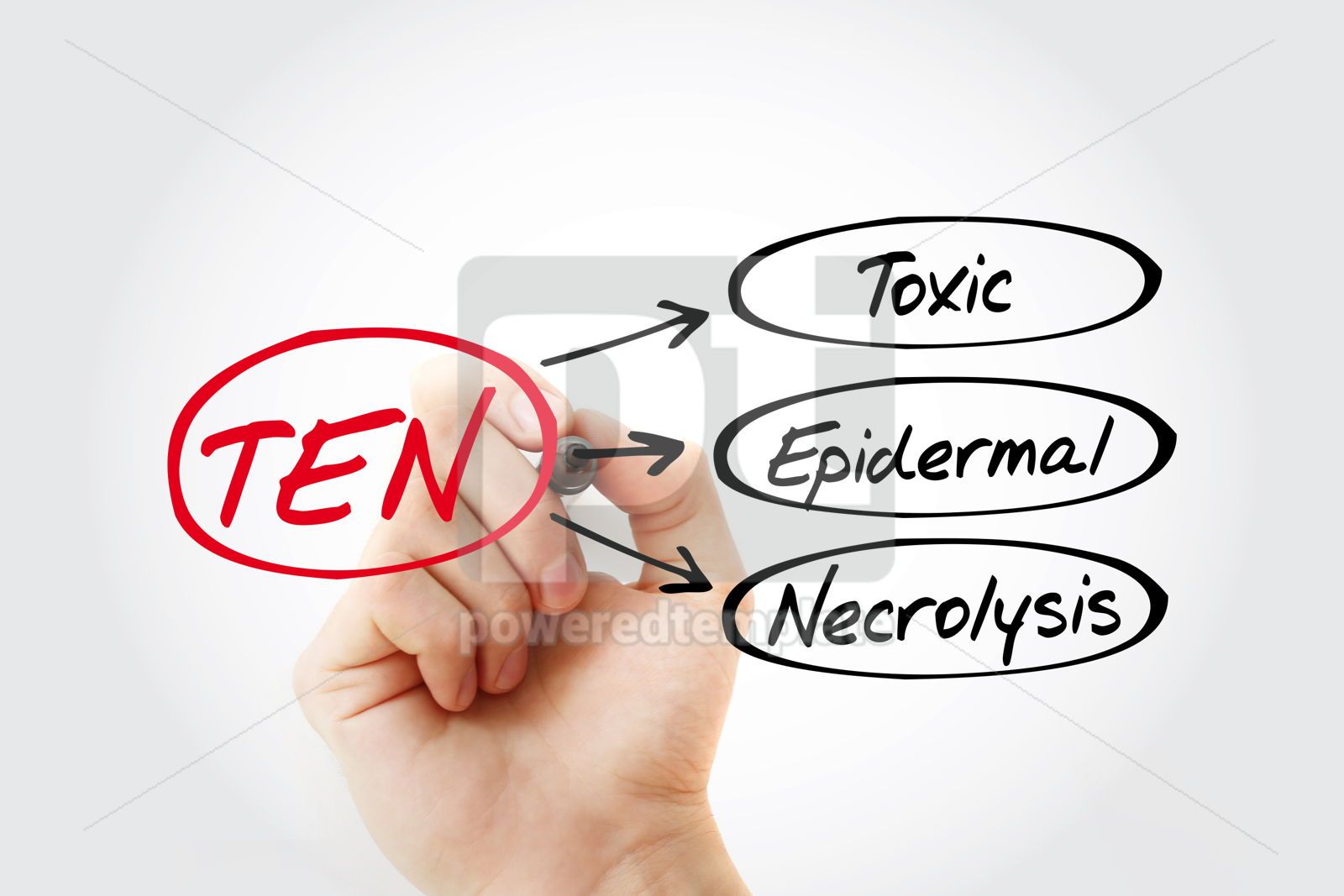 TEN - Toxic Epidermal Necrolysis acronym正版照片78657