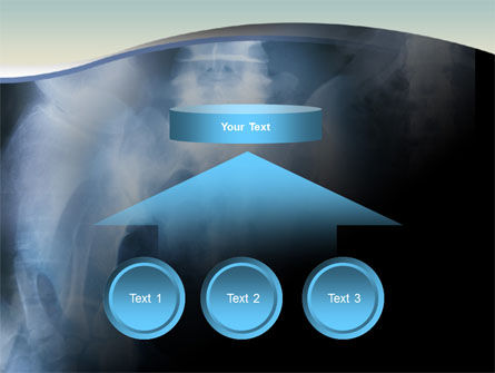 Roentgenoscopy PowerPoint Template, Backgrounds | 01276 ...