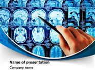 Brain MRI Scan PowerPoint Template, Backgrounds | 08061 ...